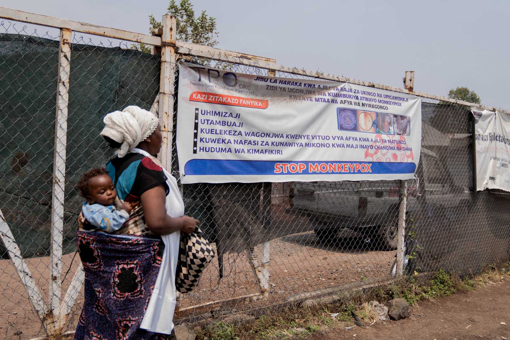 NIH Researchers Charged for Allegedly Smuggling 17 Vials of Monkeypox ...